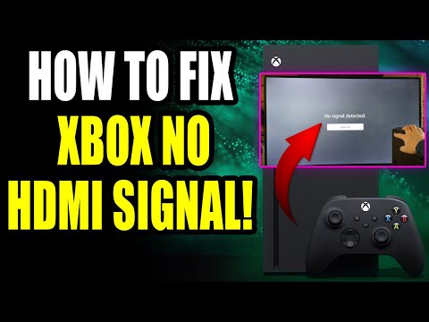 Why Won't My Xbox Show Up On My TV? – ACHIVX